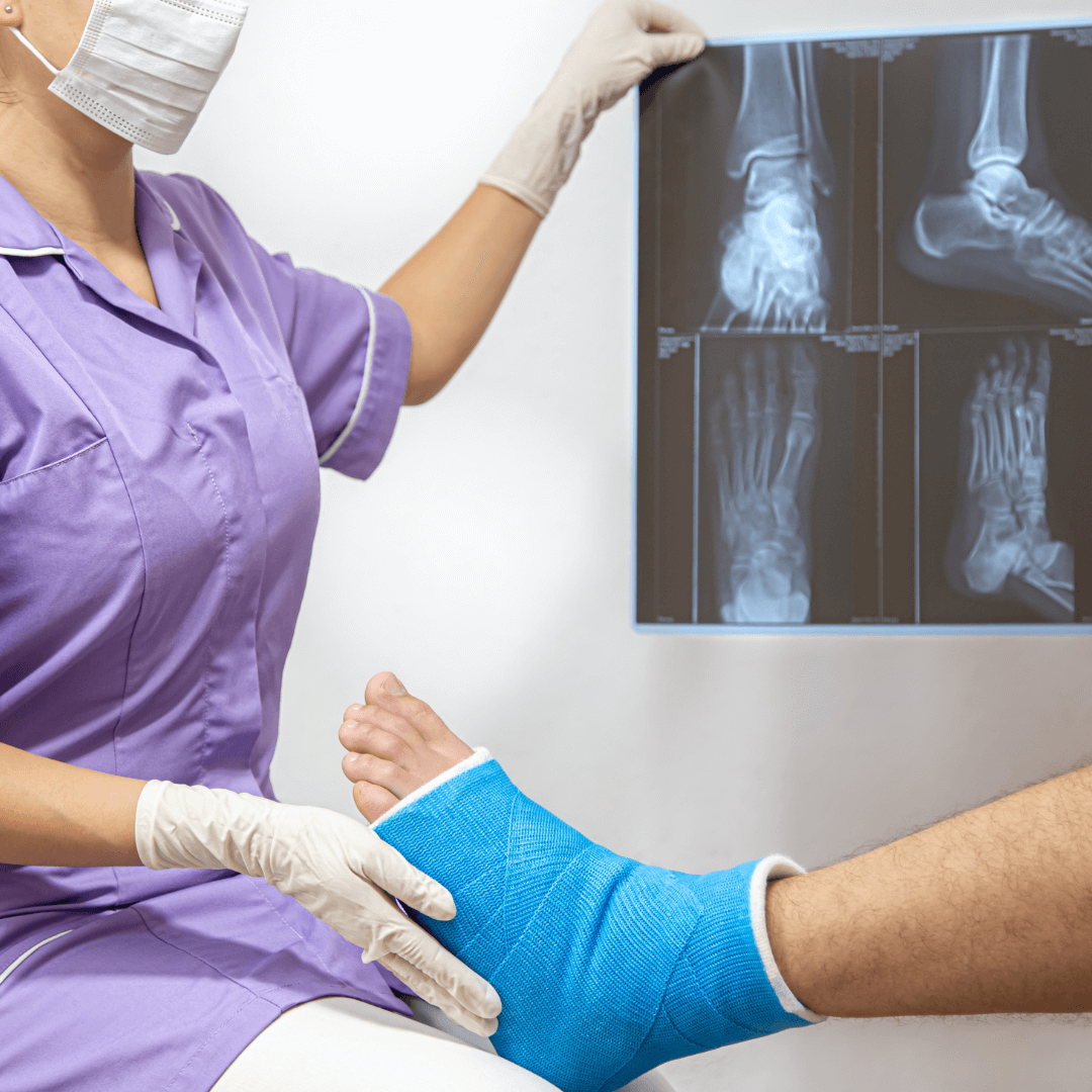 Les blessures au pied les plus fréquentes au basketball - France Podologie